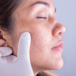 Welcome | Denver Dermatology Center